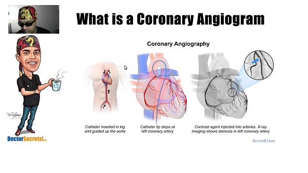 Understanding The Maze Of Cardiac Tests Why Did The Doctor Prescribe